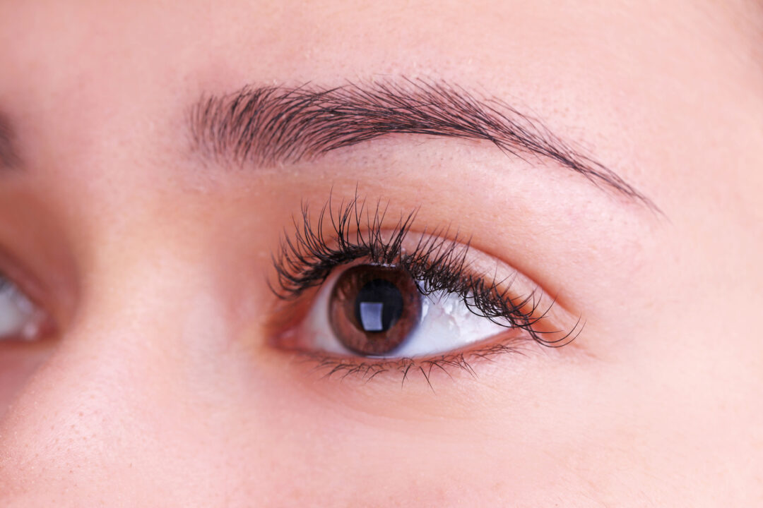 Ingrown Eyelash Home Remedy: Fix That Ingrown Lash